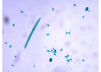 Slide – Desmids Mixed Sample - MTA Catalogue