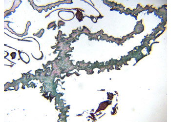 Slide – Lichen Section through Thallus - MTA Catalogue