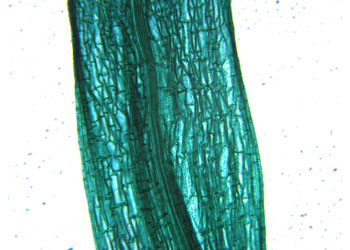 Slide – Fern Prothallium of Antheridia WM - MTA Catalogue