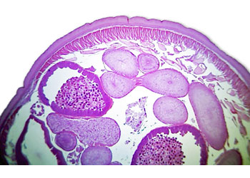 Slide – Ascaris Female CS - MTA Catalogue