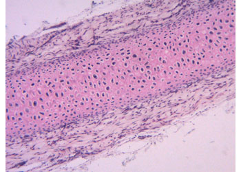 Slide – External Ear - MTA Catalogue